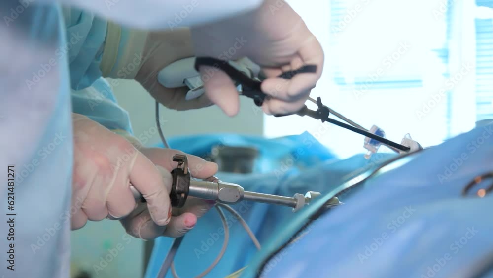 Surgeons team hands during laparoscopic abdominal operation. Operation ...