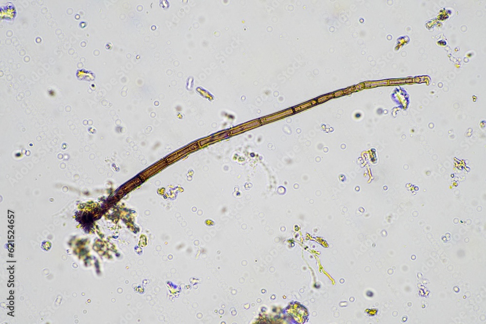 fungal hyphae under the microscope Stock Photo | Adobe Stock