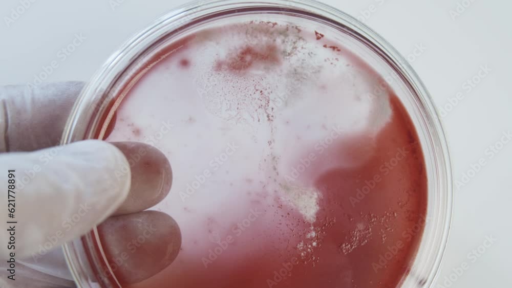 Bacteria culture growth on a petri dish in microbiology lab. Candida ...
