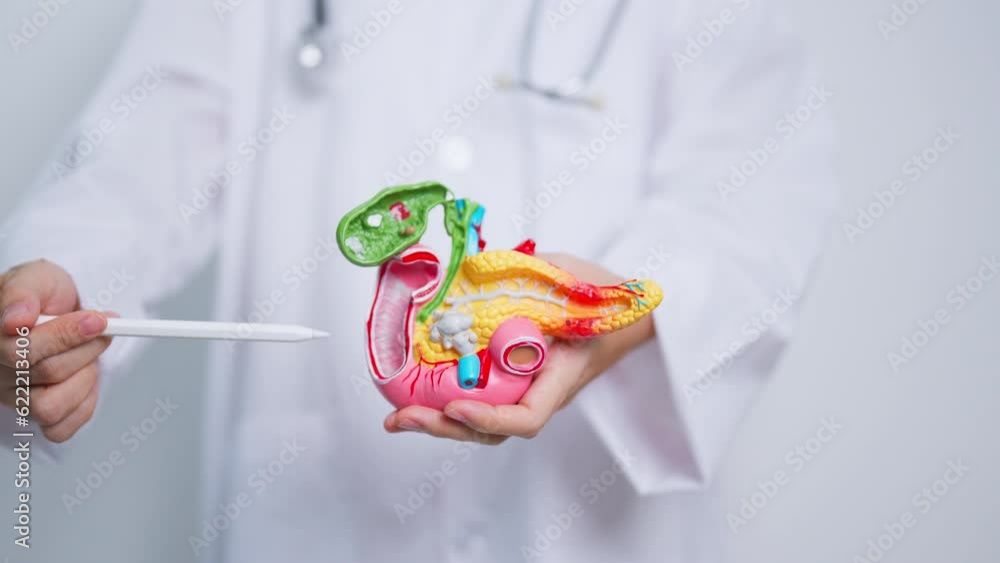 Doctor with human Pancreatitis anatomy model with Pancreas, Gallbladder ...