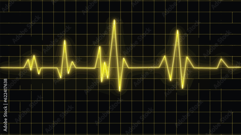 Yellow heartbeat diagram on red graph paper. Electrocardiogram chart ...