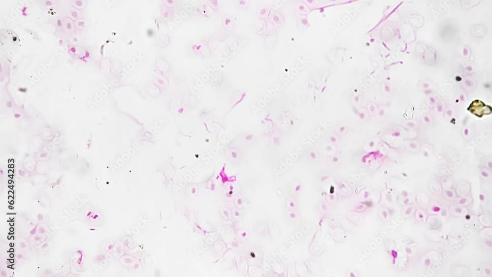 Human blood smear magnified under microscope 400x against white ...