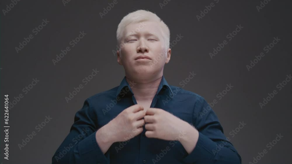 Portrait of an Asian albino guy. An eastern man with a genetic mutation ...