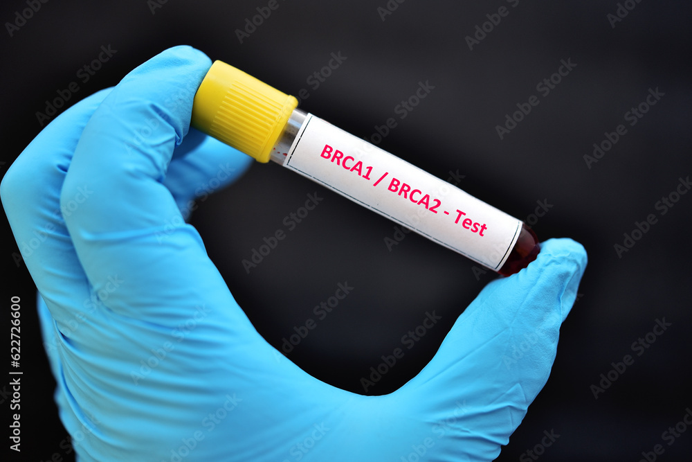 Blood sample for BRCA1 and BRCA2 test, gene marker for breast cancer ...