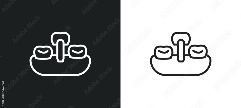 overdenture outline icon in white and black colors. overdenture flat ...