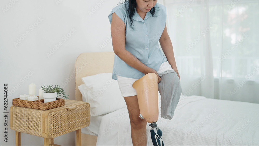 Adult asian women amputee wearing leg prosthesis equipment after wake ...