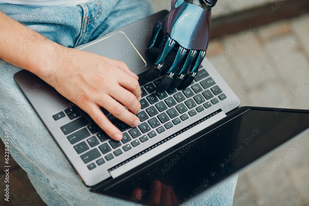 Top view of man with prosthetic hand typing on computer Stock Photo ...