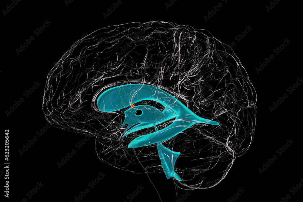 The interventricular foramen, also known as the foramen of Monro, 3D ...