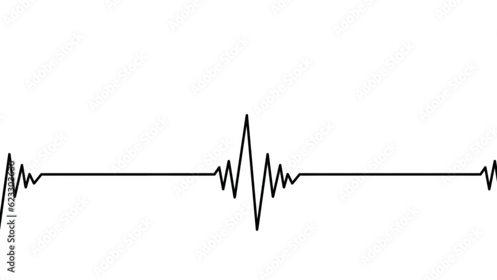 Black heartbeat diagram, Electrocardiogram chart, Cardio test line ...