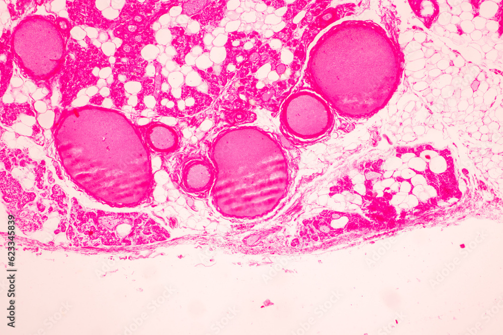 Showing Light micrograph of the Trachea, Thymus, Parathyroid gland and ...