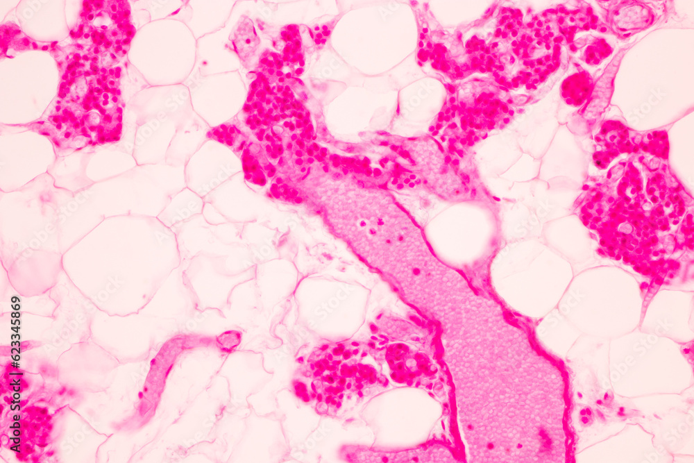 Fotografia do Stock: Showing Light micrograph of the Trachea, Thymus ...