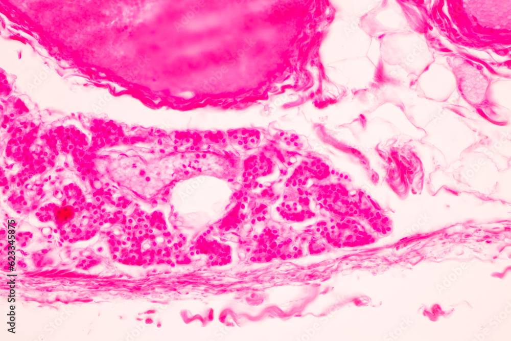 Showing Light micrograph of the Trachea, Thymus, Parathyroid gland and ...