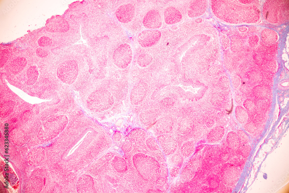 Fotografia do Stock: Showing Light micrograph of the Trachea, Thymus ...