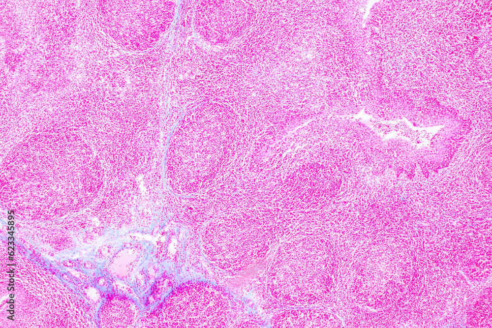 Fotografia do Stock: Showing Light micrograph of the Trachea, Thymus ...