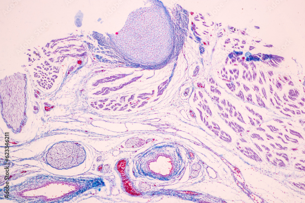 Fotografia do Stock: Showing Light micrograph of the Trachea, Thymus ...