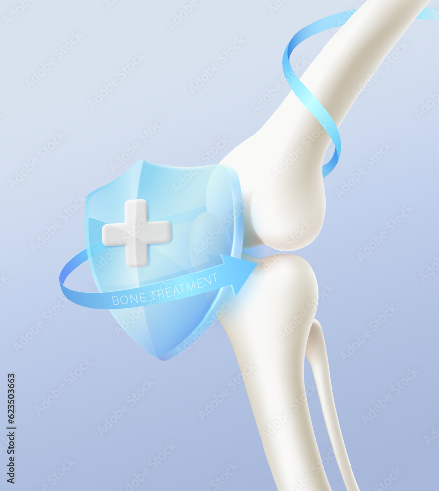 Bone protection and treatment by specialized doctors. Realistic ...
