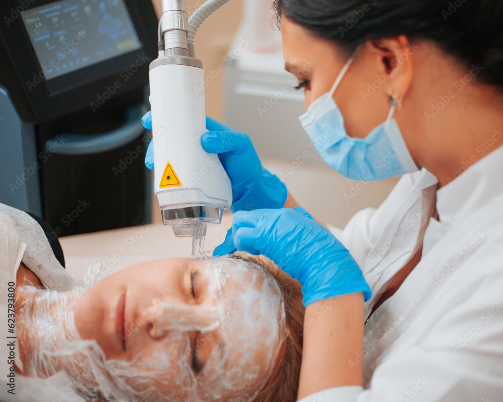 Procedure Laser resurfacing is a procedure in which a laser beam ...