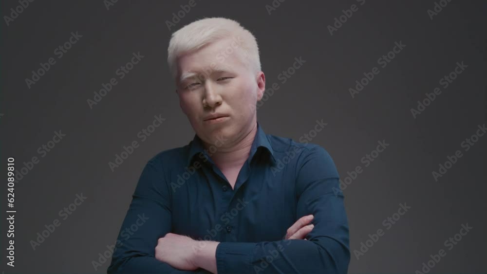 Portrait of an Asian albino guy. Eastern man with a genetic mutation of ...