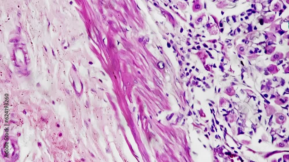 Section of human stomach pattern magnified in 400 times under ...