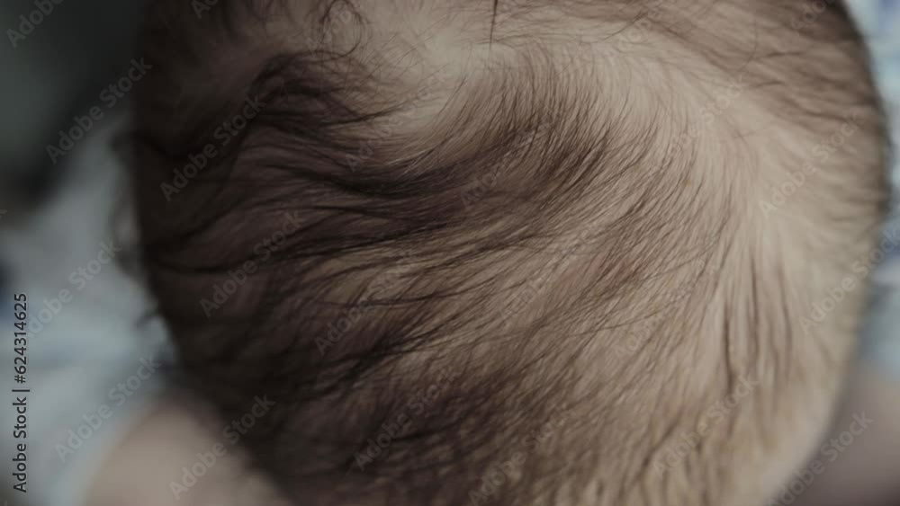 Smearing a seborrheic crust with baby oil on a child's head. Combing ...