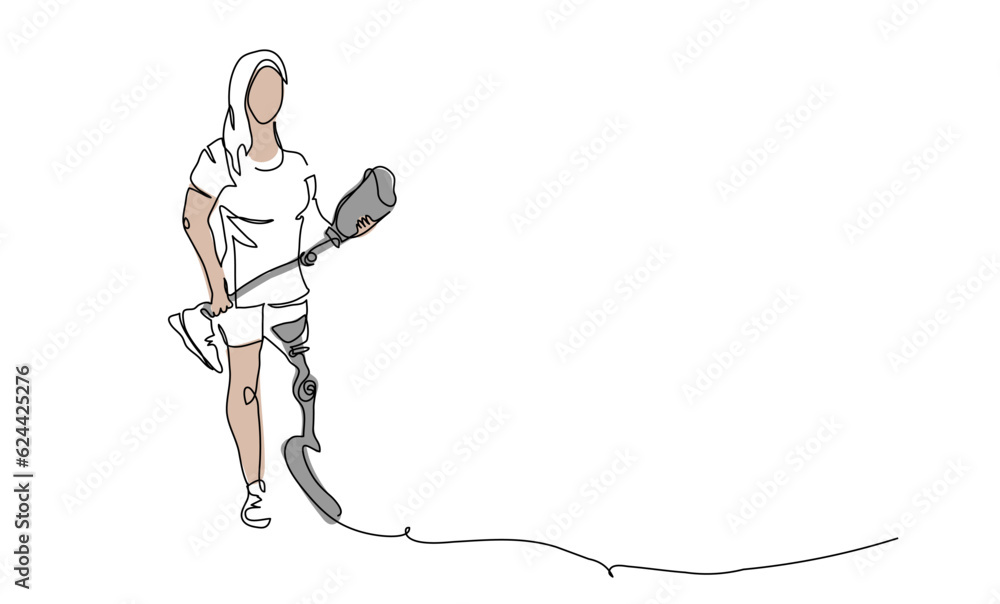 Girl, woman standing on prosthesis. Woman has prosthetic leg ...