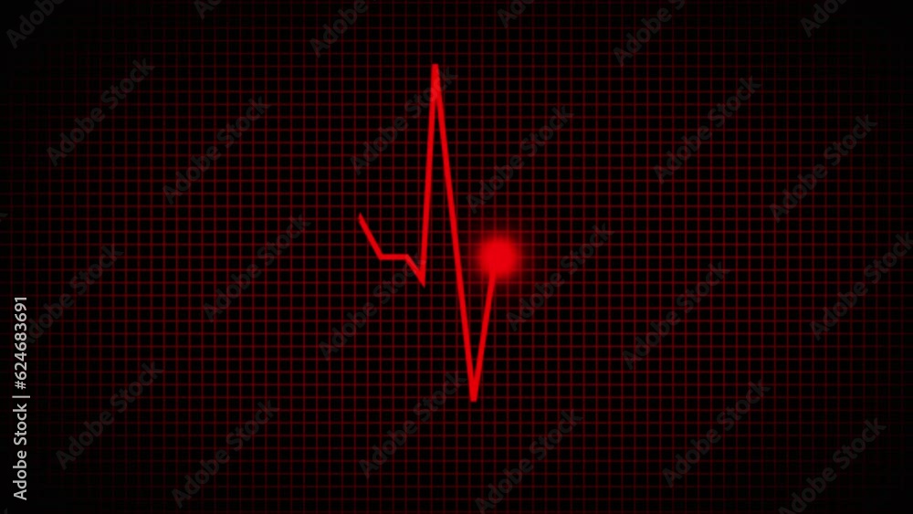 ECG monitor and heartbeat line. An animated heartbeat display ...