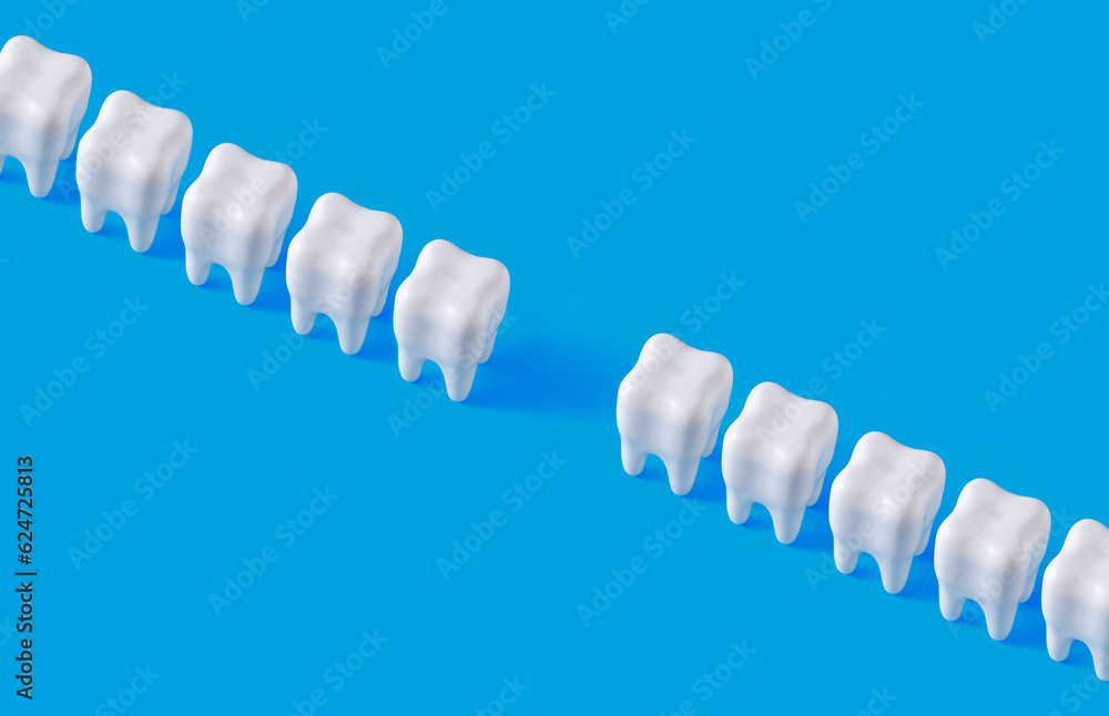 Row of white teeth and gap between them. Concept of absence, loss of ...