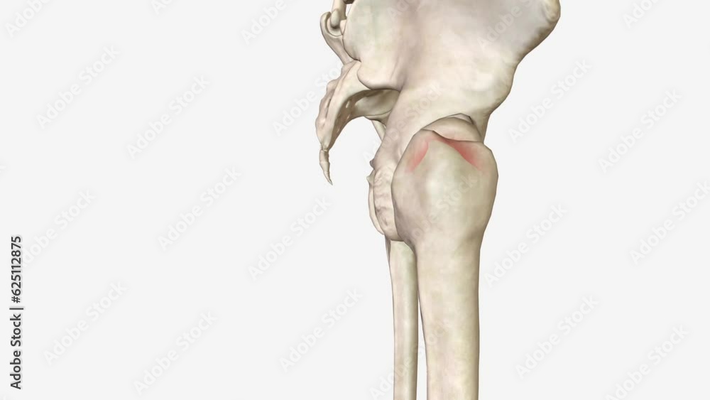 Femoral neck fractures are a specific type of intracapsular hip ...