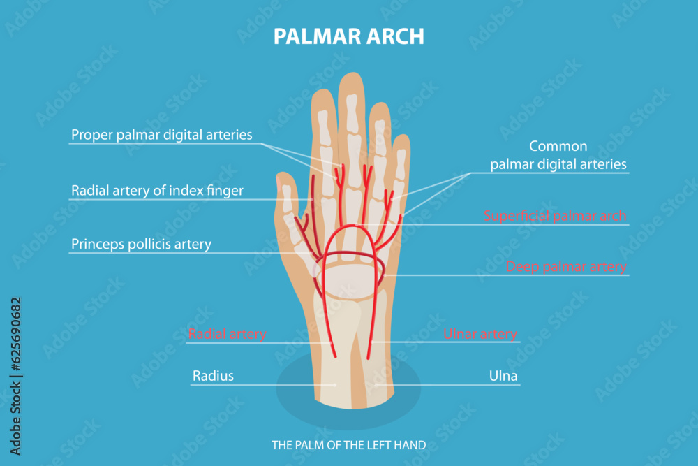 3D Isometric Flat Vector Conceptual Illustration of Palmar ARCH, Health ...