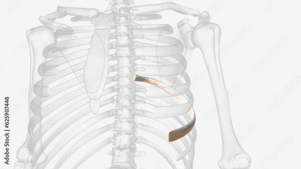 The rib remnant of the 7th cervical vertebra on one or both sides is ...