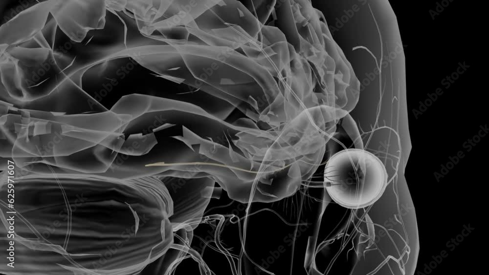 he trochlear nerve is the fourth cranial nerve (CN IV) and one of the ...