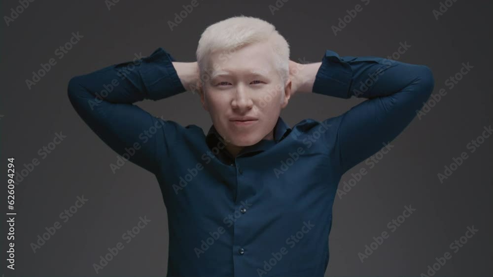 Vidéo Stock Portrait of an Asian albino guy. Eastern man with a genetic ...