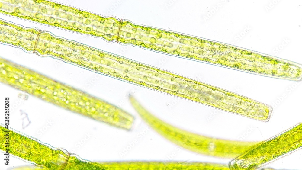 Freshwater microalgae (Pleurotaenium sp.) blooming under microscope ...