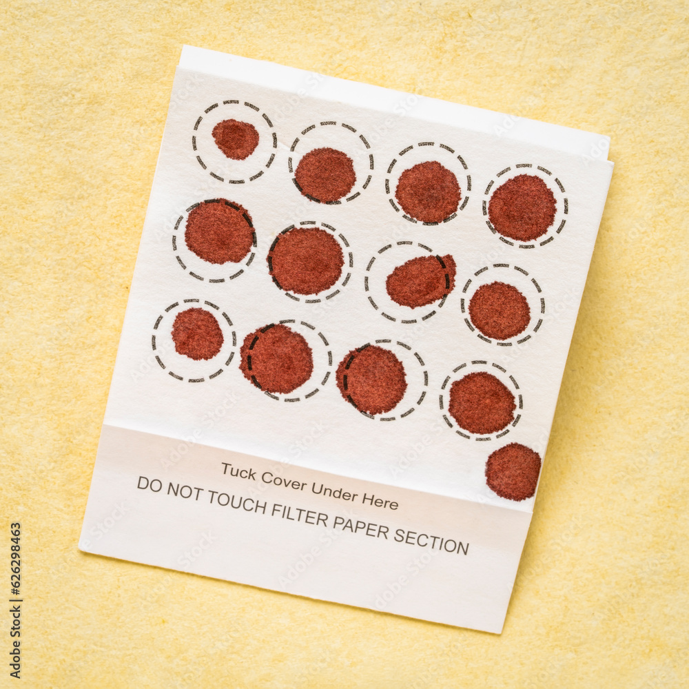 dry blood spots on a fiber filter for laboratory analysis, home health ...