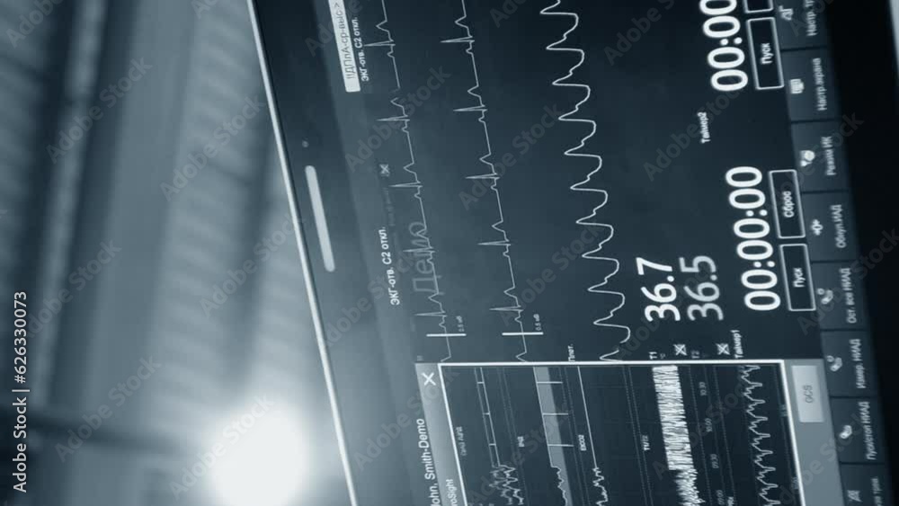 Modern patient monitor. Electronic Health Monitor displaying medical ...