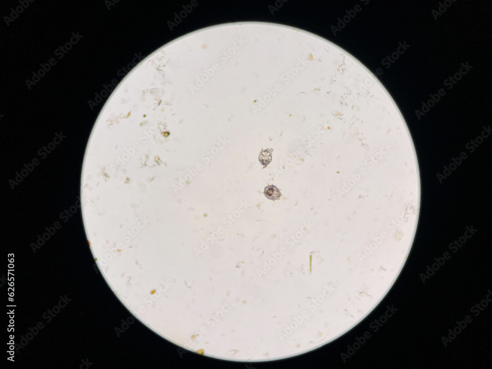 Notoedres cati under the microscope. Notoedric mange, also referred to ...