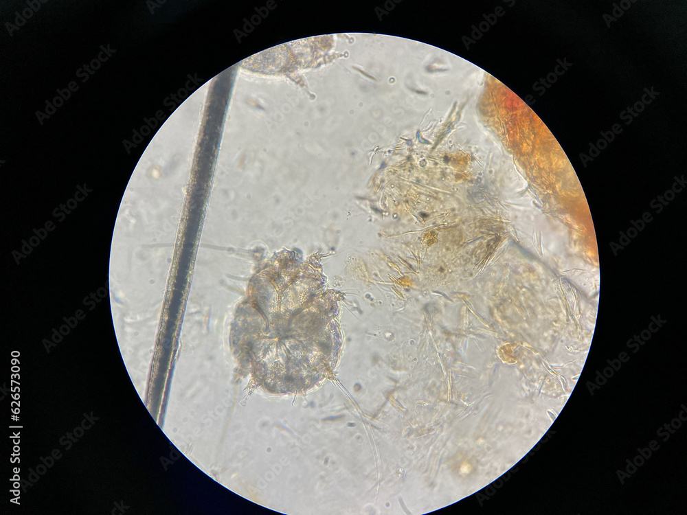 Notoedres cati under the microscope. Notoedric mange, also referred to ...