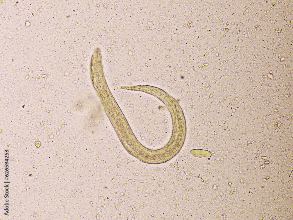Strongyloides stercoralis or threadworm in human stool, analyze by ...