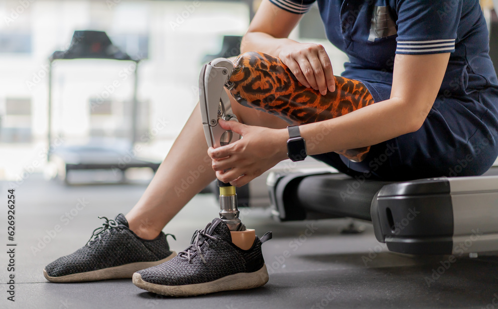 Woman with prosthetic leg sits isolated in gym. Asian female with foot ...