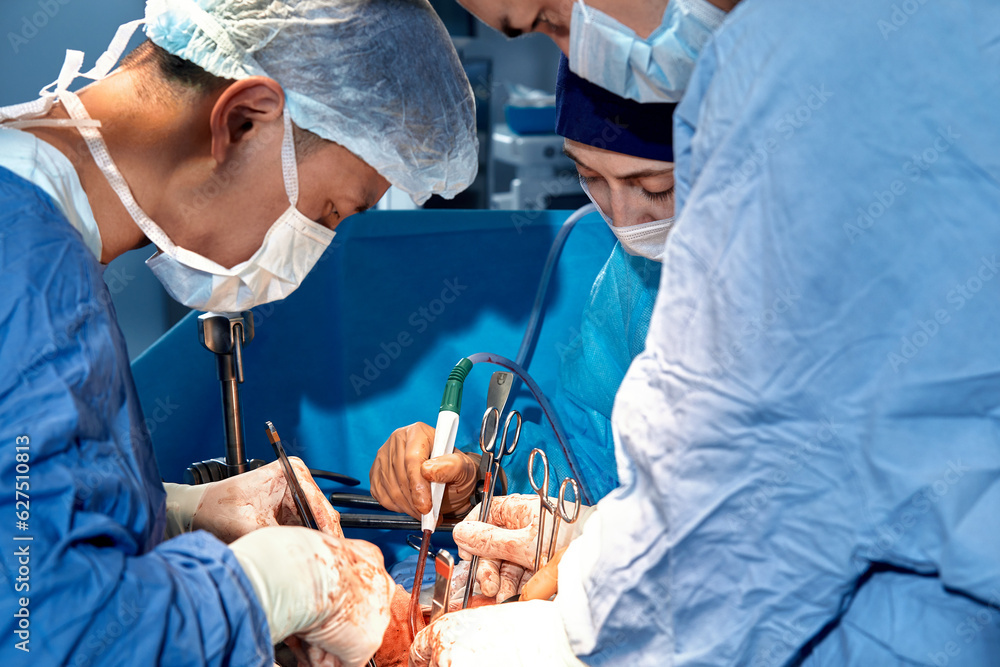 Surgeons team during complex surgical operation in a sterile operating ...