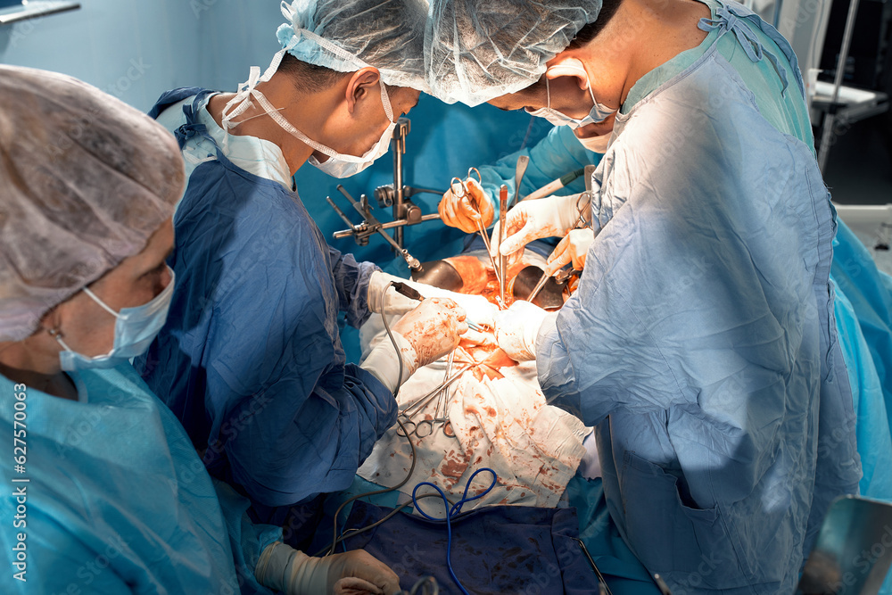Top view of surgeons team during complex surgical operation in a bright ...