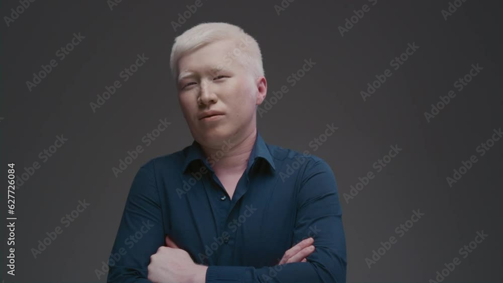 Portrait of an Asian albino guy. Eastern man with a genetic mutation of ...