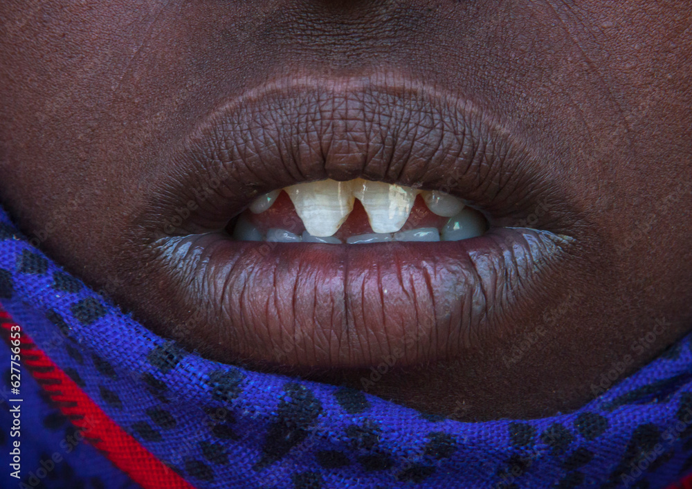Afar Tribe Woman With Sharpened Teeth Assaita Afar Regional State