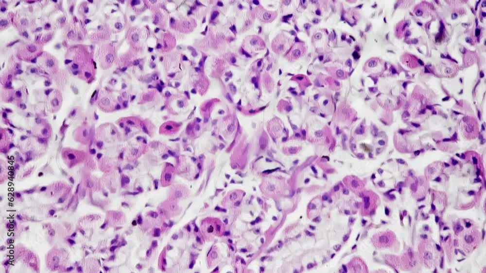 Stomach fundic portion in section filmed under microscope 400x on ...