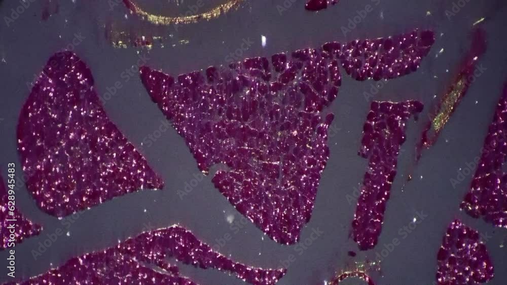 Section of lamellar corpuscle in human organism magnified under ...