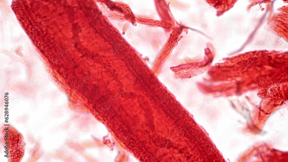 Highly magnified a whole mount of smooth muscle 400x against bright ...