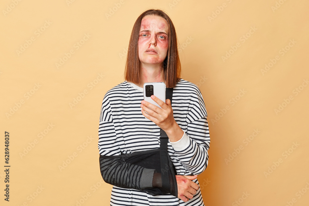 Sad unhappy cryinginjuredwoman with bruise on face and arm trauma ...