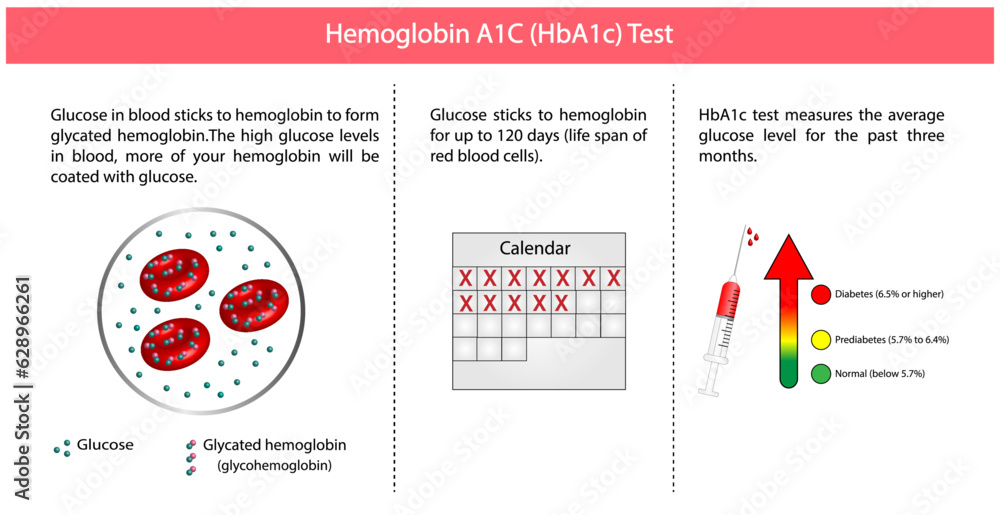 Hemoglobin A1C, HbA1c test , HbA1c levels, Glucose sticks to hemoglobin ...