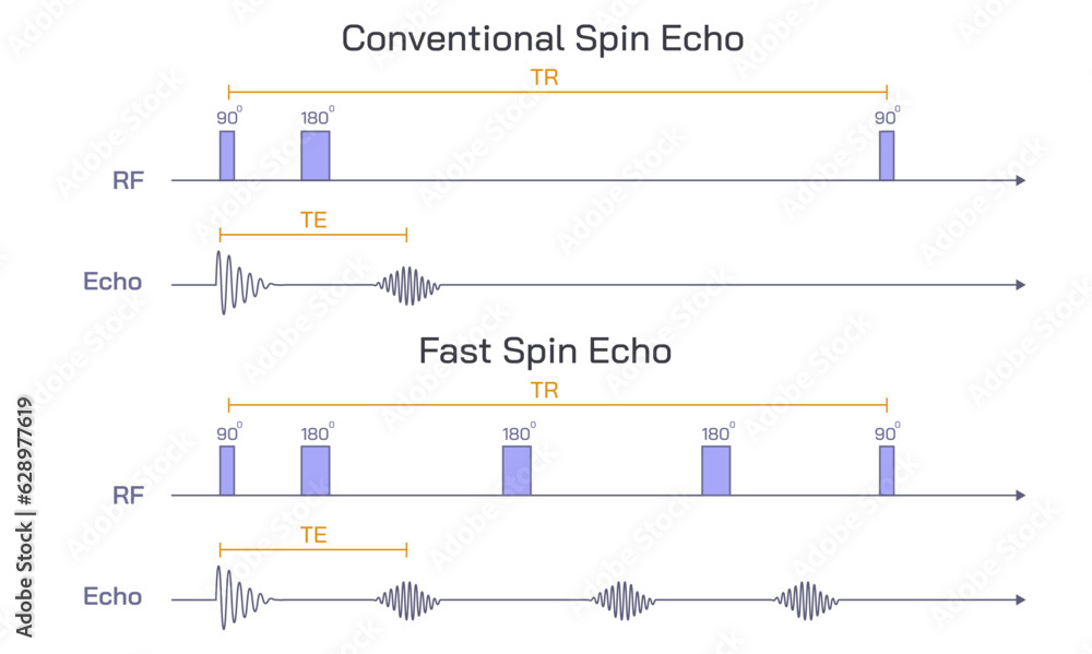 Gradient echo sequences, radiology reference article images, MRI ... Gradient echo sequences, radiology reference article images, MRI ...