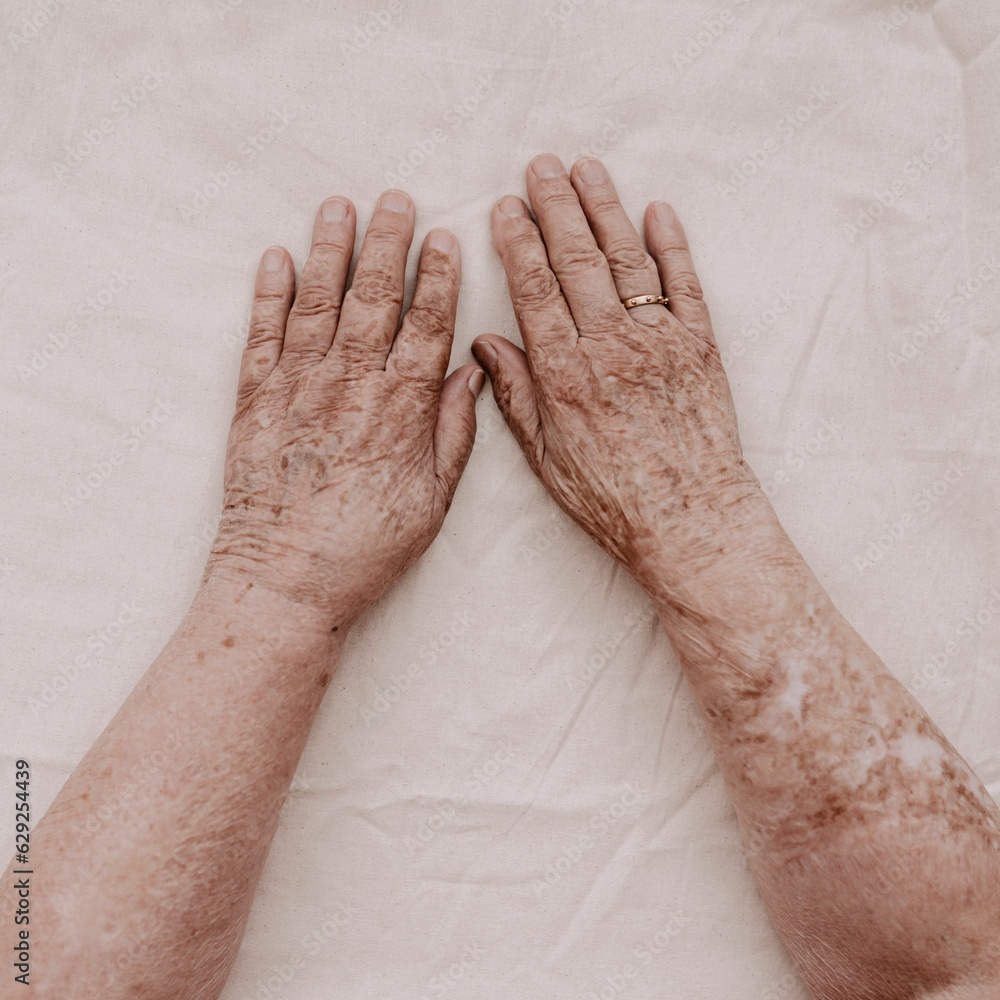 Elderly woman's hands are seen resting on a white surface, her wrinkled ...